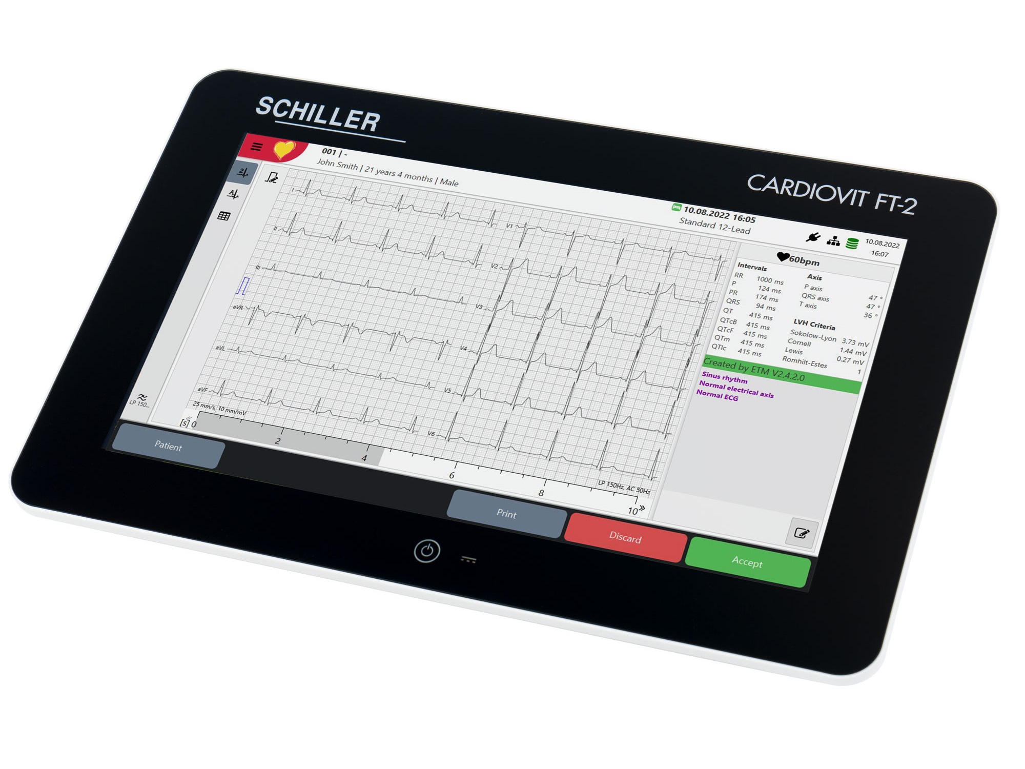 CARDIOVIT FT-2 - Schiller